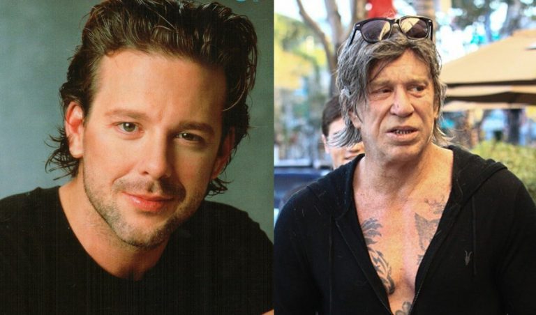 Stars Who Spoiled Their Beauty Because of Plastic Surgery